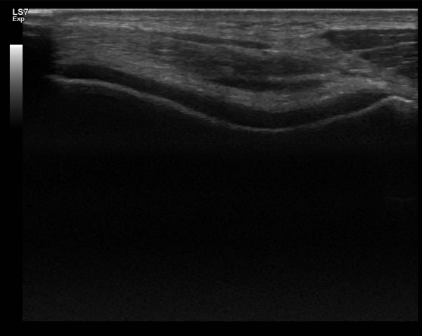 Polven ultraäänitutkimus: Käynnit alkaen 159 € » Oulun Ultra